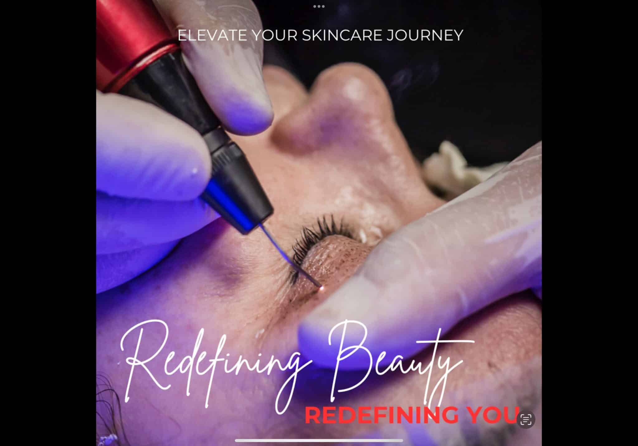 Plasmage Treatment Searcy AR - Eyelid Lift White County AR